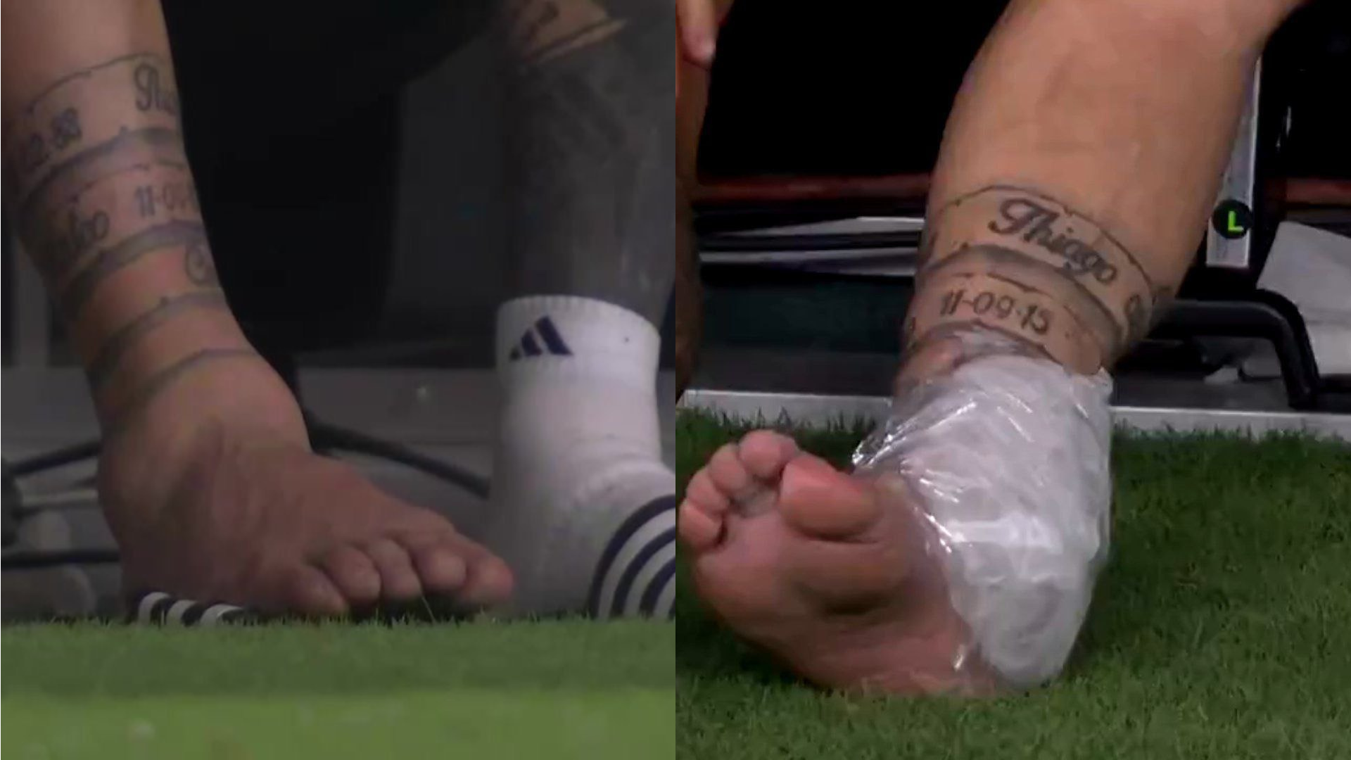5 Common Football Injuries: causes, prevention, and fast recovery ...